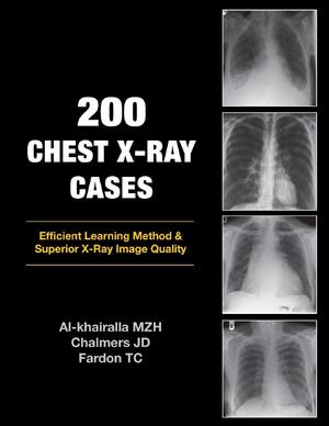 200 Chest X-Ray Cases - Mudher Al-khairalla, James Chalmers, Tom Fardon ...