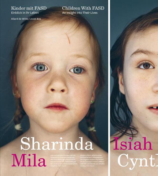 Children With FASD Kinder mit FASD - Allard de Witte, Joost Bos - (ISBN ...